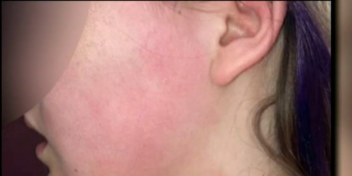 Student speaks out after allegedly being slapped by teacher Student speaks out after allegedly being slapped by teacher